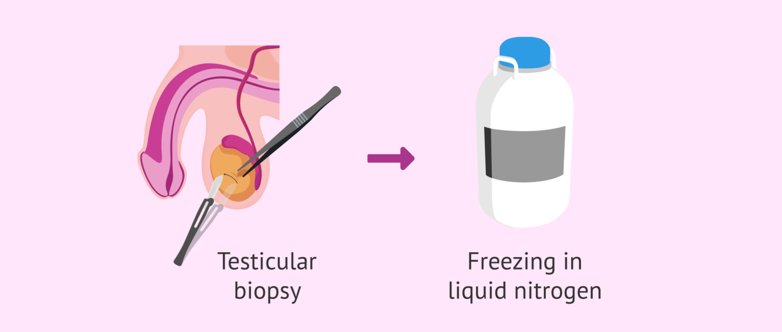 freezing-testicular-tissue