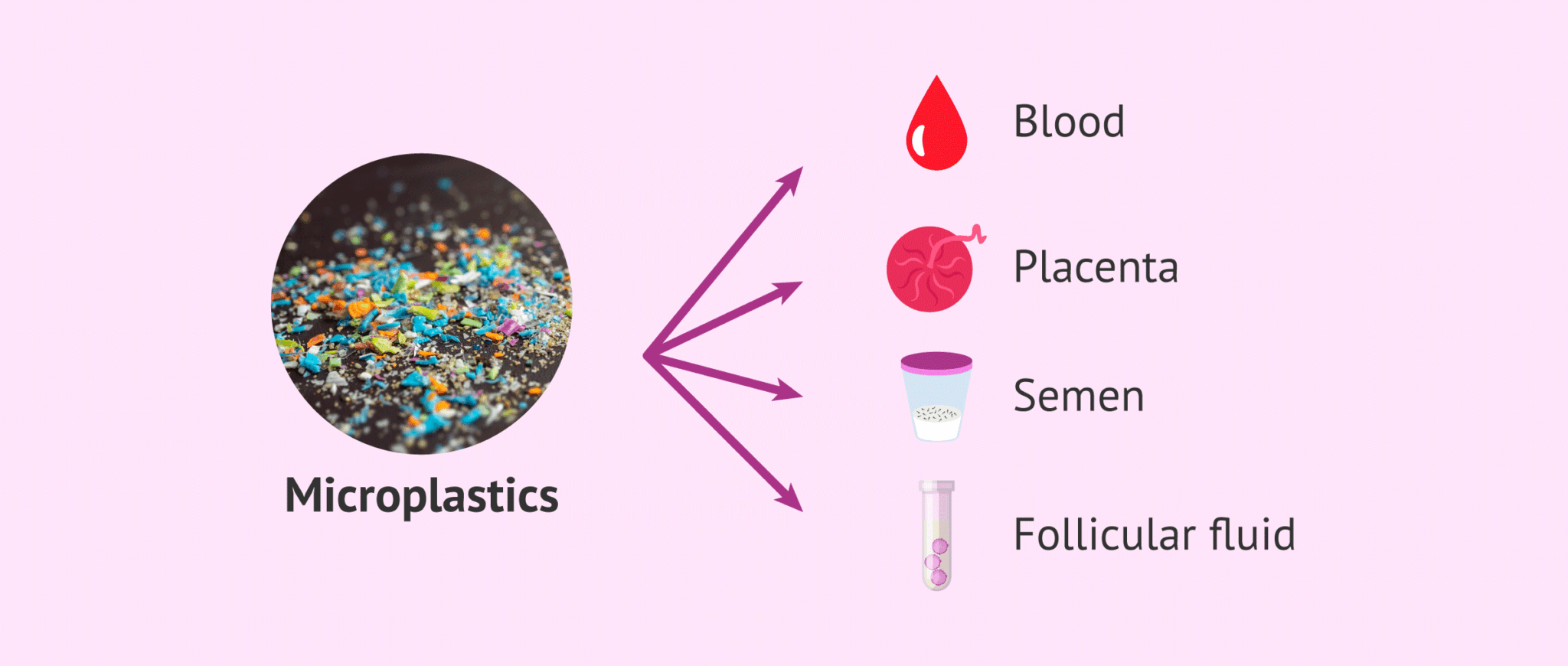 Presence of microplastics in the human body