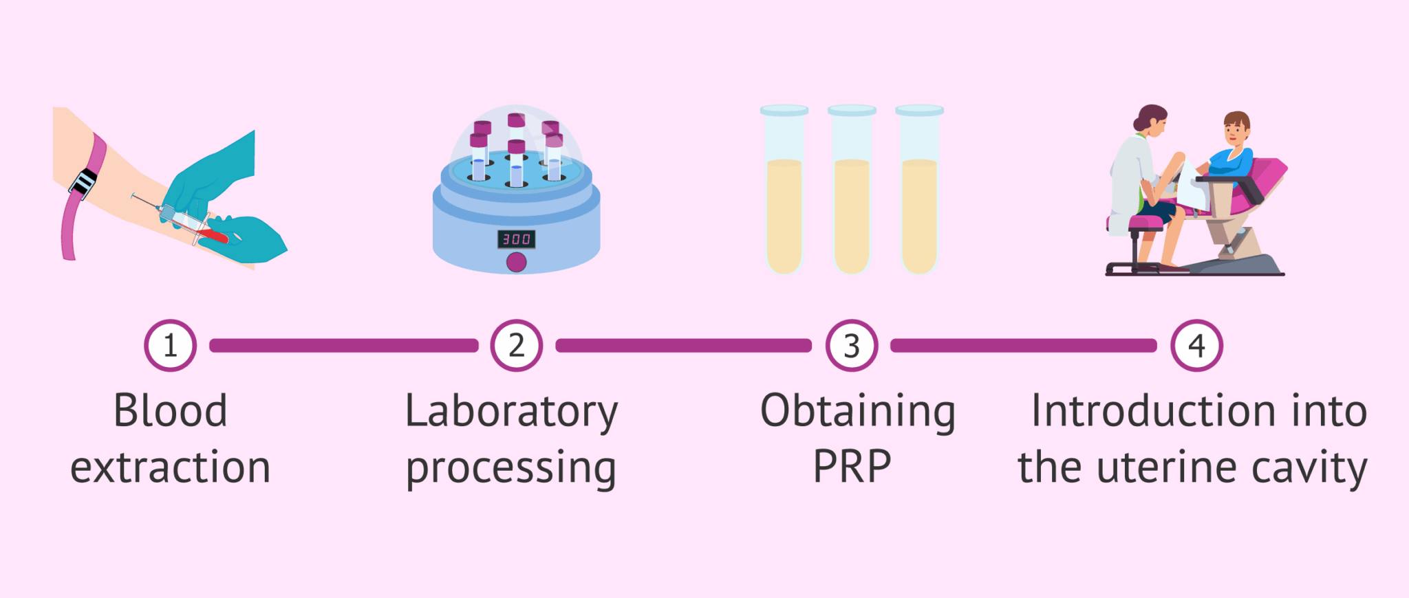 Platelet-rich plasma to improve pregnancy chances