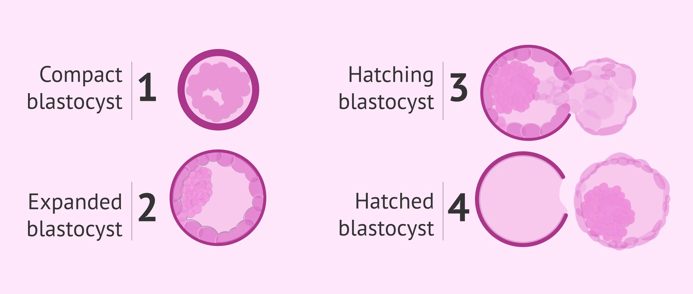 Frozen Embryo Transfer Assisted Hatching Laser Assisted Hatching: