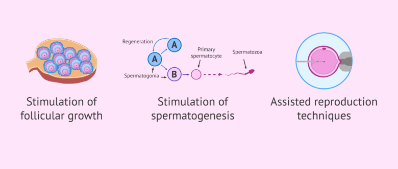 Menopur: Patient's Manual for Ovarian Stimulation in IVF