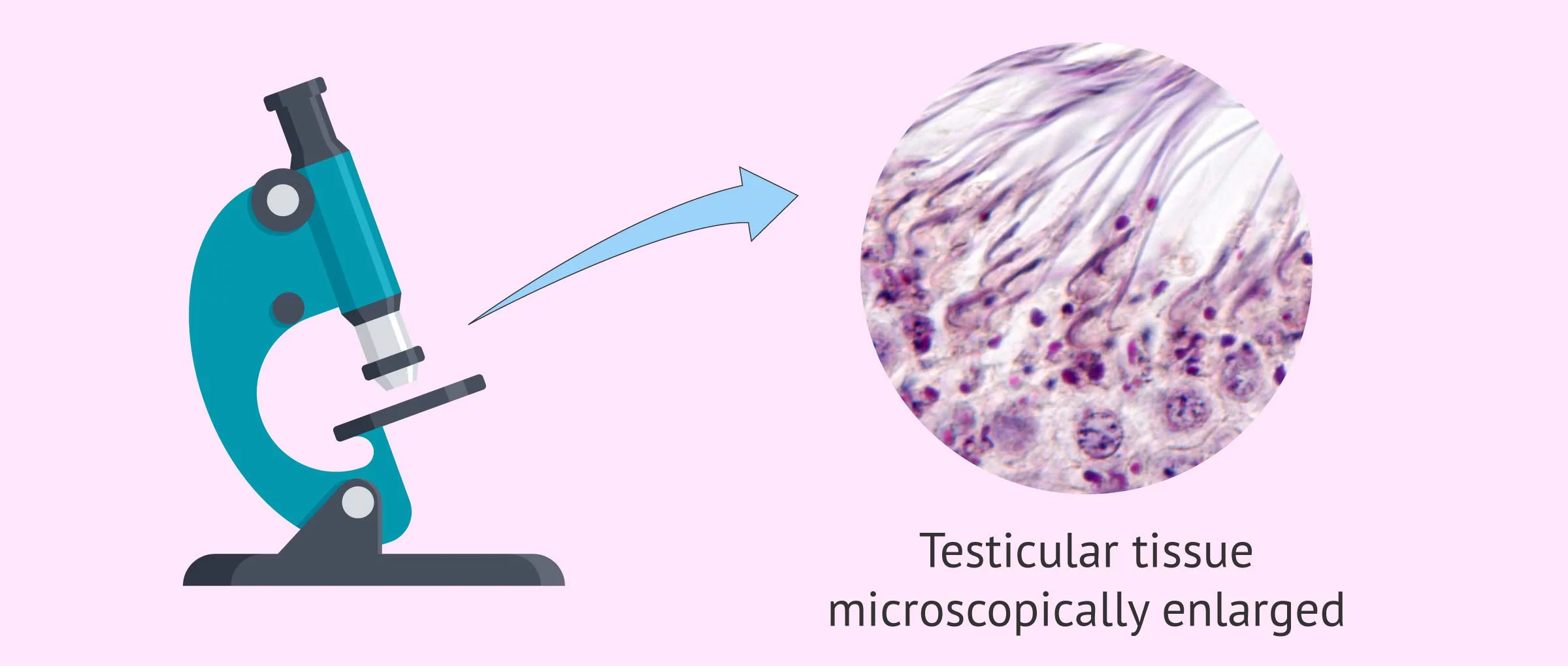 Observation Of Testicular Tissue Under The Microscope