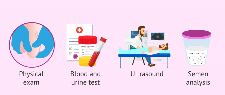 Epididymitis or Inflamed Testicles: A Cause For Male Sterility?