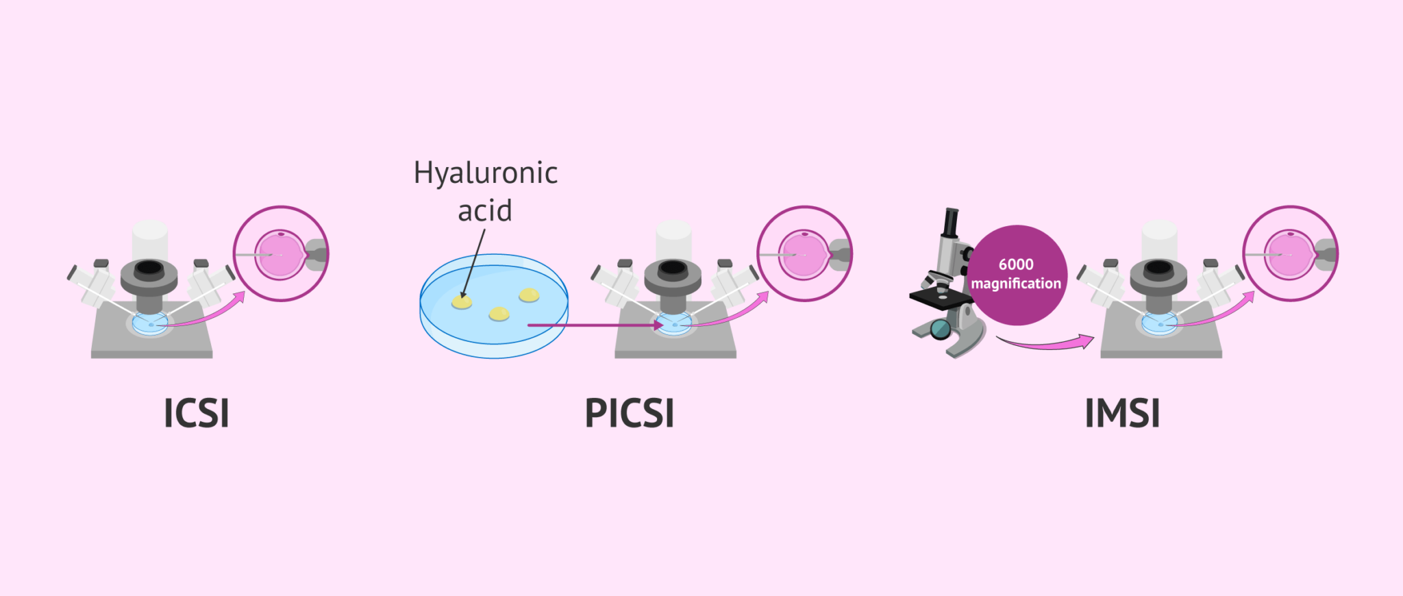 What Is PICSI or Physiological ICSI in IVF?