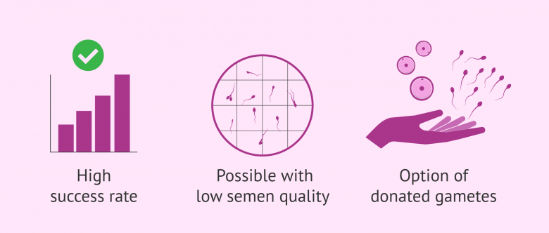 In vitro fertilization (IVF) - What is it and how much does it cost?