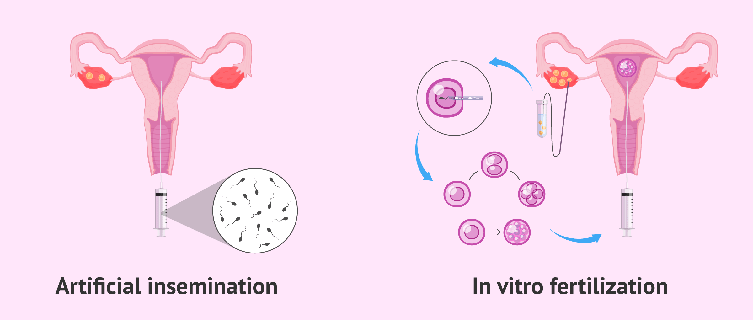 Main Assisted Reproduction Techniques