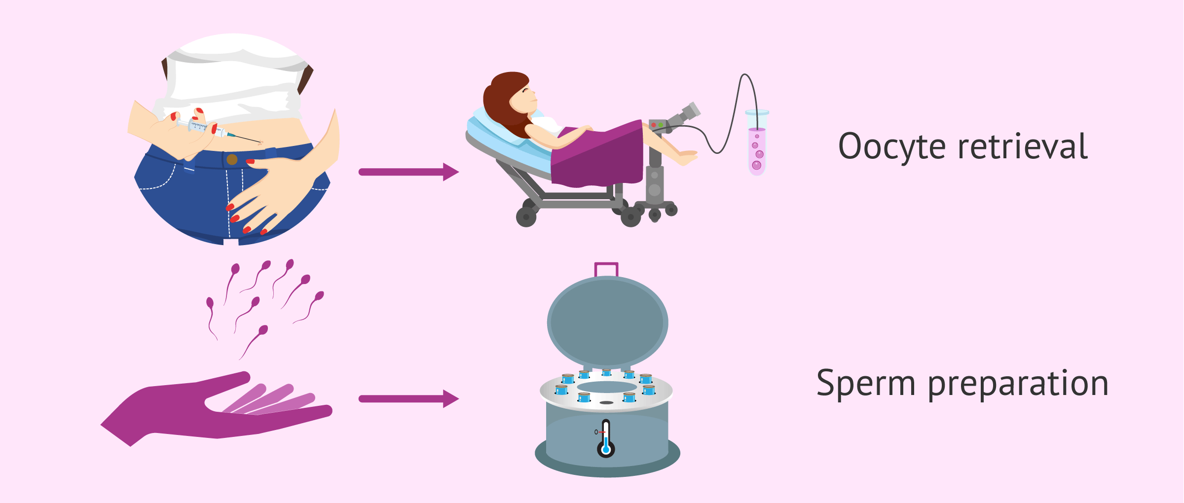 IVF Using Donor Sperm The Process Costs And Its Success Rates
