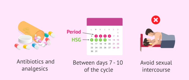 What is hysterosalpingography (HSG): why and how is it performed?