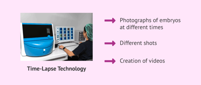 What Is Time-Lapse Technology in IVF? - Definition & Benefits