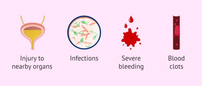 Planned cesarean section, when is it indicated, and what are the risks?