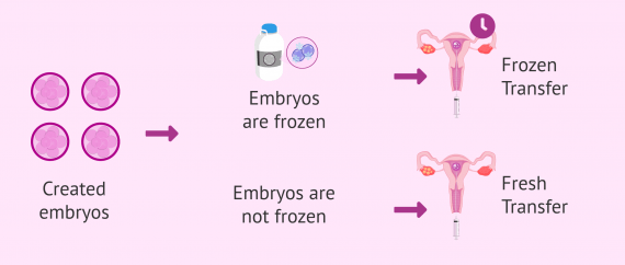 Embryo transfer types