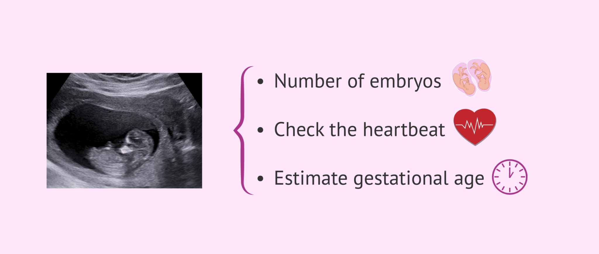 What can be seen on a first trimester ultrasound?