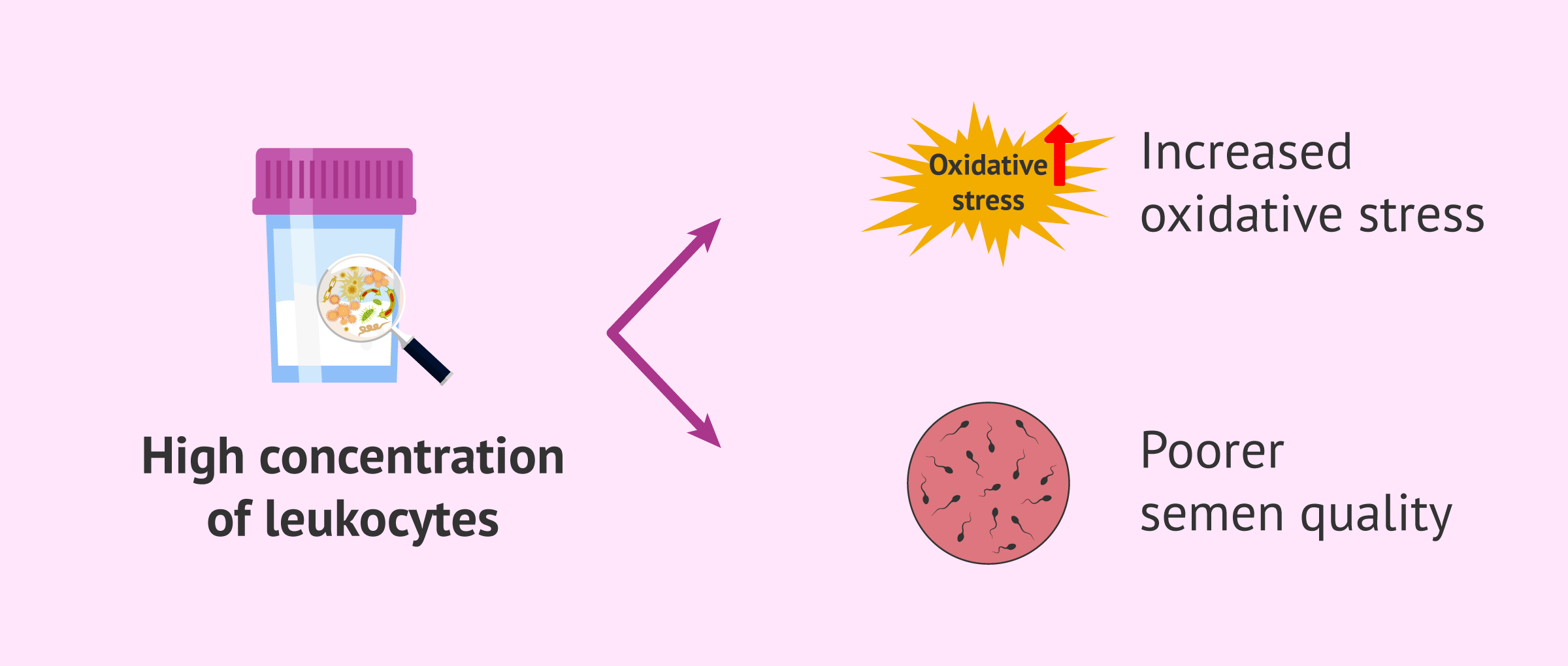 Altered Semen Count With Many Leukocytes Altered Semen Count With Many Leukocytes