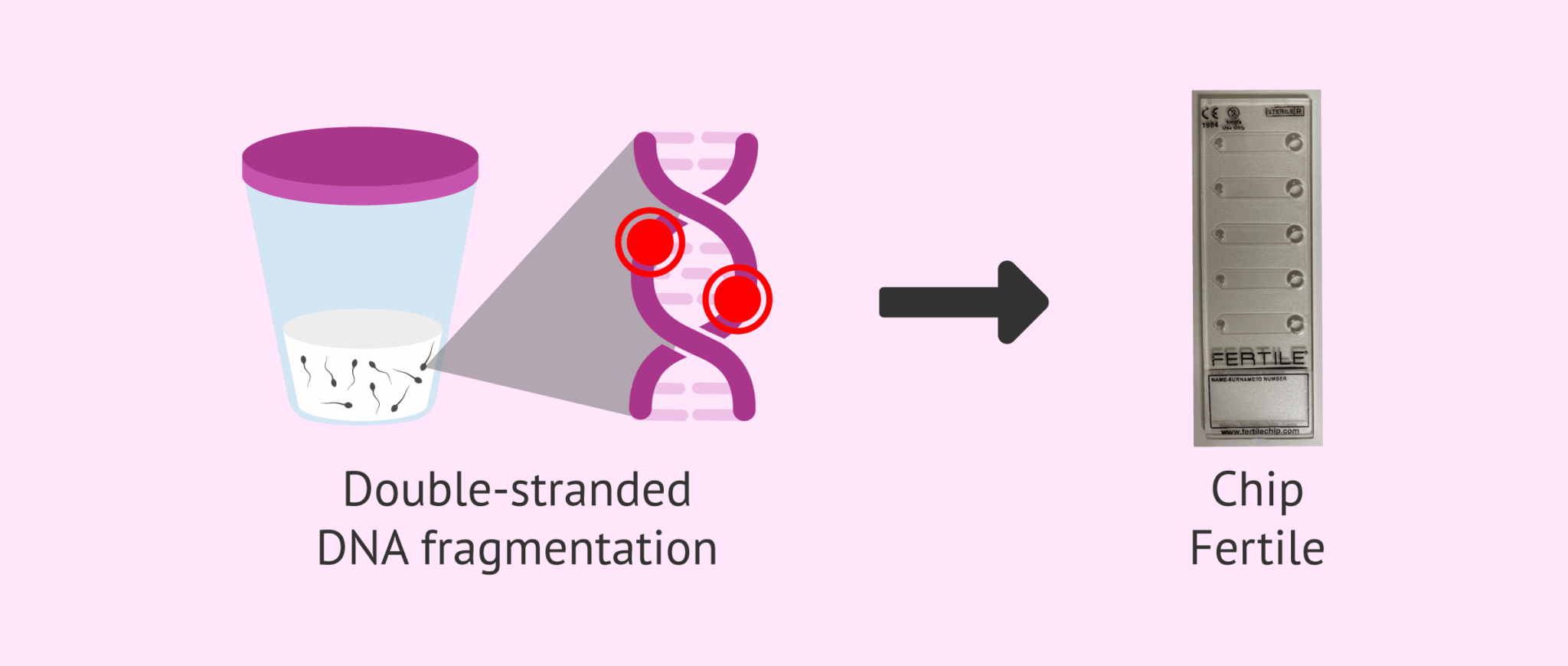 Sperm DNA Fragmentation - Causes & Effect on Fertility