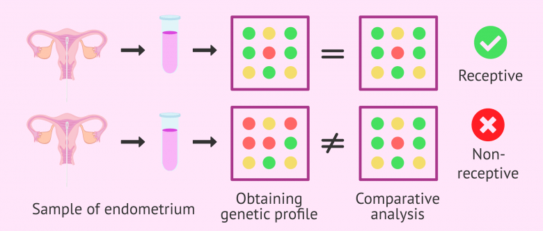 Endometrial Receptivity Array (ERA): Procedure and Success Rates