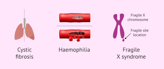 Examples of monogenic diseases