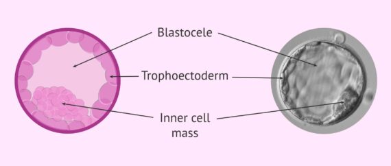 Structure of a blastocyst