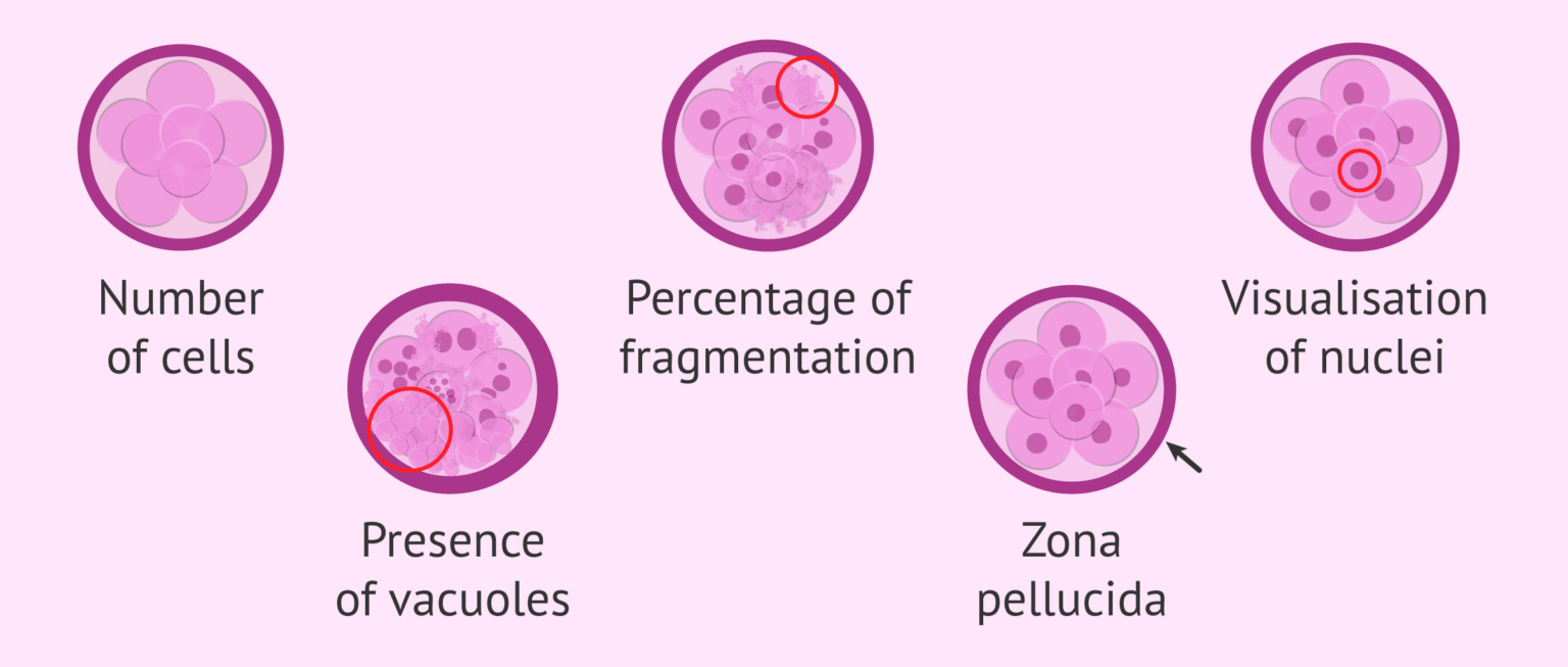 Embryo Quality & Grading - Does It Affect IVF Success?