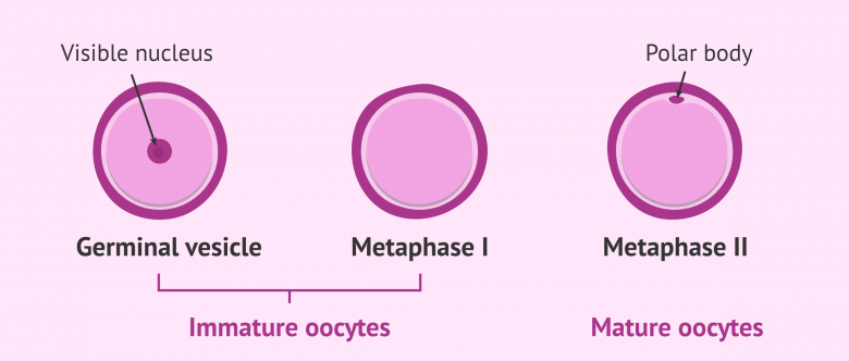 In Vitro Maturation of Oocytes (IVM) in Assisted Reproduction