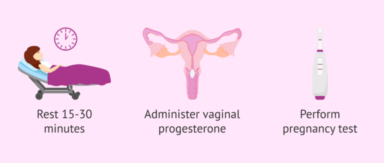 Controlled ovarian stimulation in Artificial Insemination