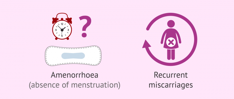 What is the infantile uterus and what is the likelihood of pregnancy?