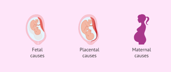 Amniotic fluid abnormalities: causes, symptoms and treatment