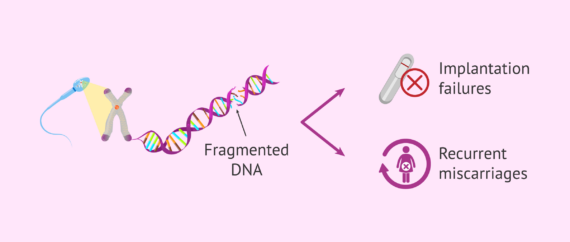 Consequences of sperm DNA fragmentation
