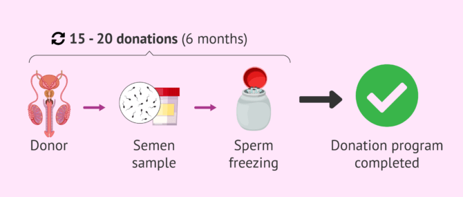 How is sperm donation explained step by step?