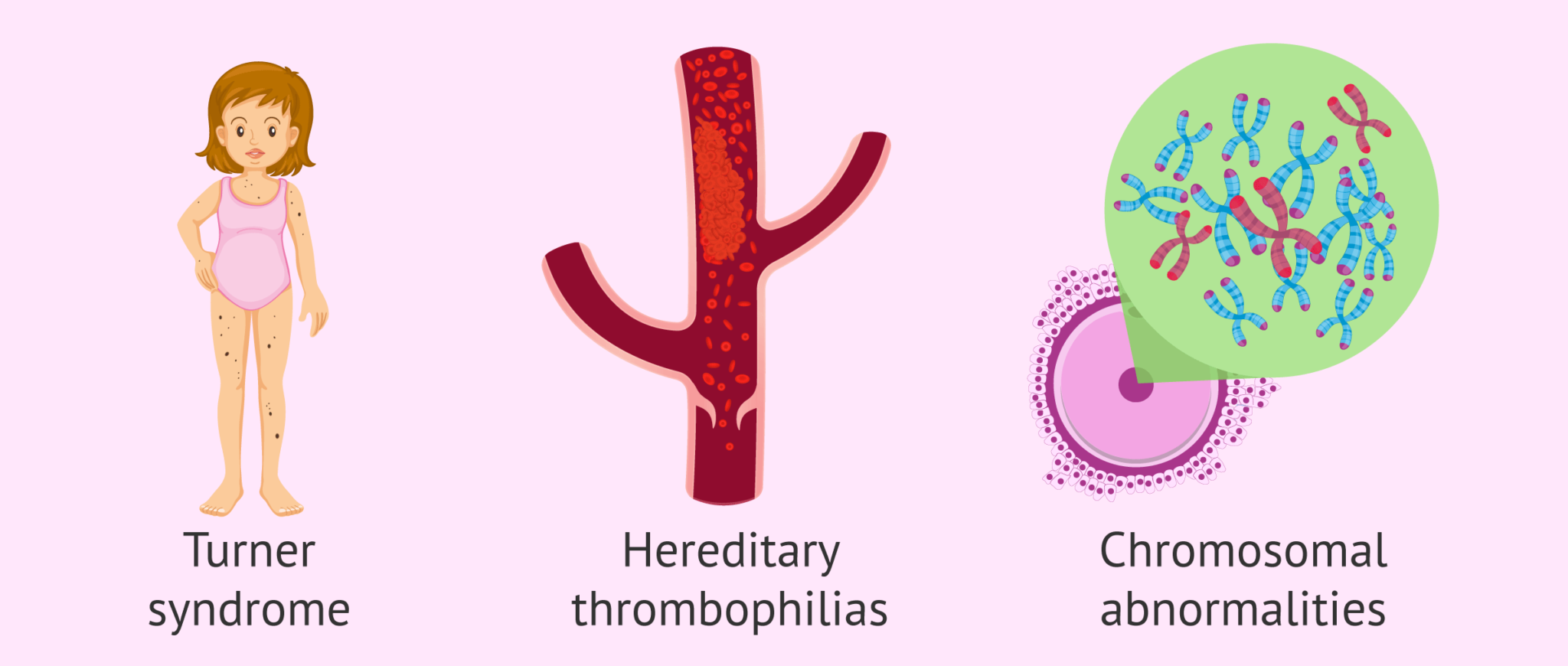 Genetic infertility: causes, diagnosis and treatment