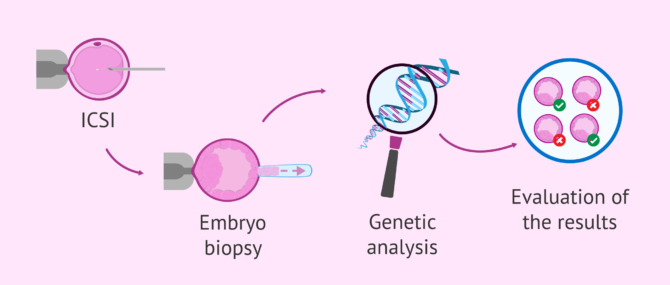 How is the PGD performed?