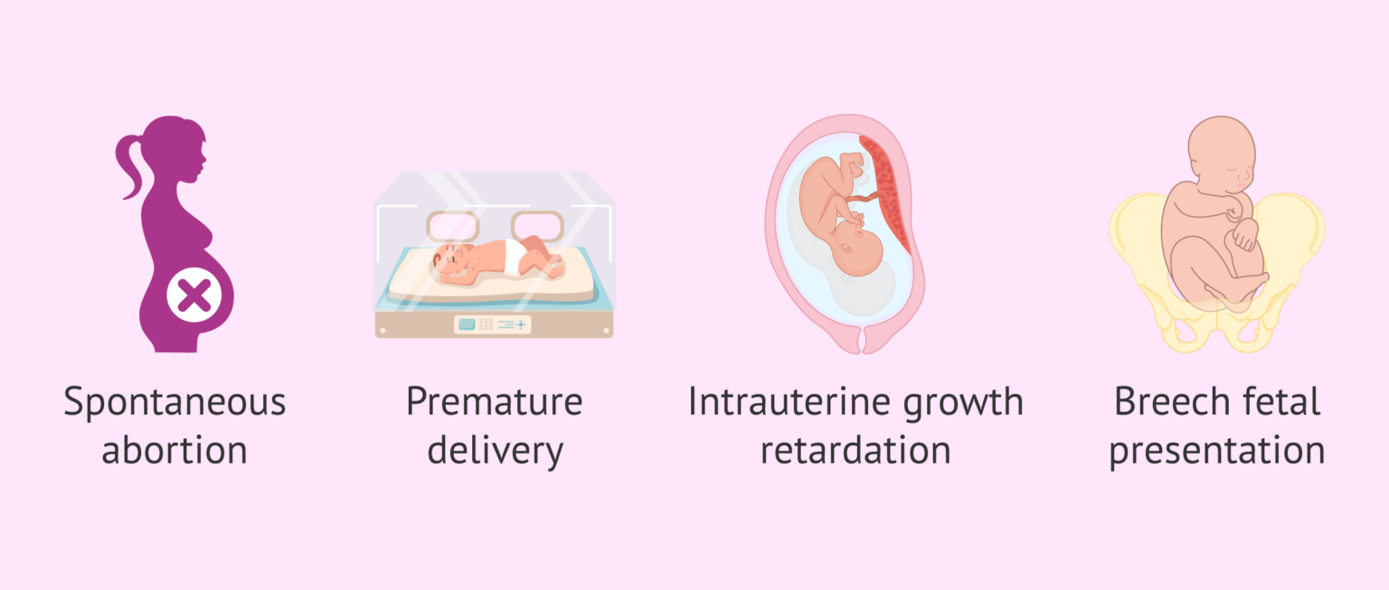 What is a bicornuate uterus? Is it possible to achieve pregnancy?
