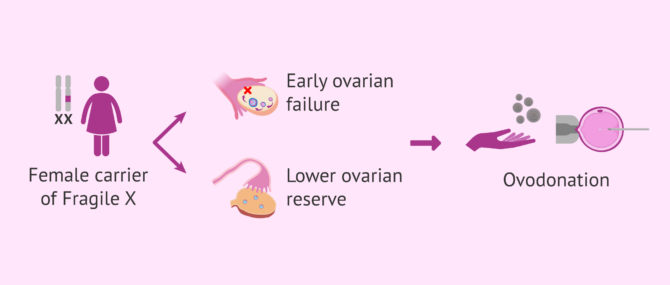 Option to achieve a pregnancy in women with Fragile X and low reserve