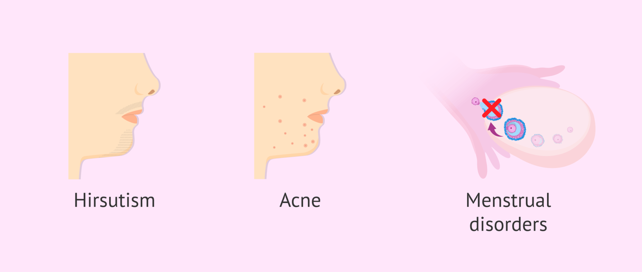 What is the role of testosterone in women?