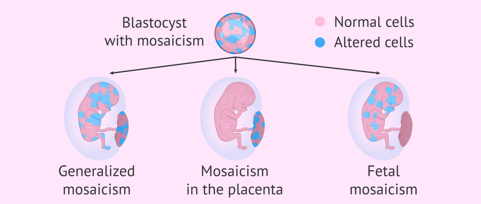 Mosaicism confined to the placenta