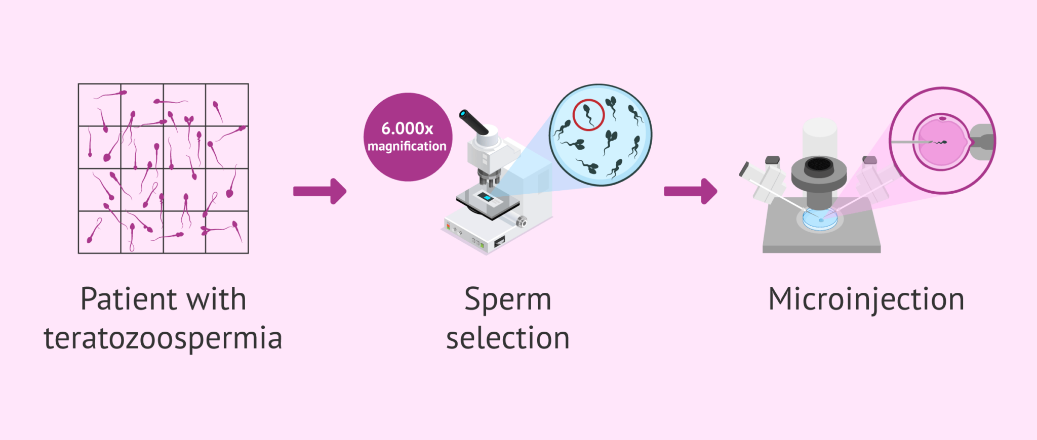 What treatments are available for male infertility?