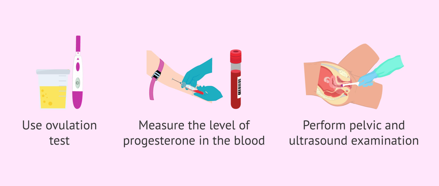What is anovulation? - Causes, symptoms and treatment