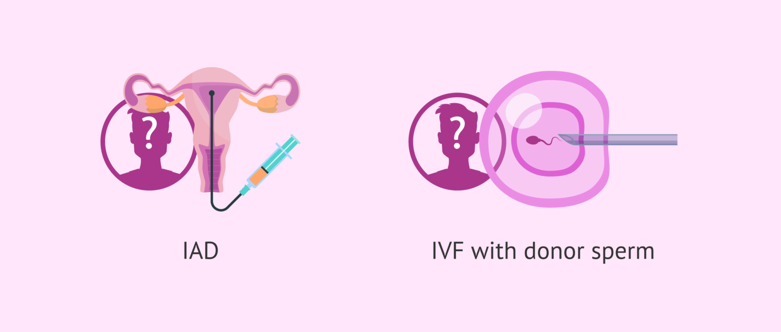 What fertility treatments are recommended for single women?