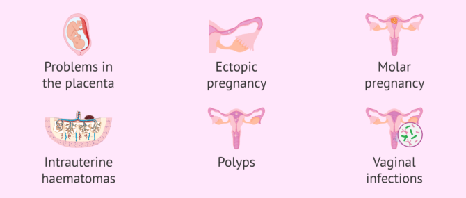 Other Possible Causes Of Vaginal Bleeding During Pregnancy