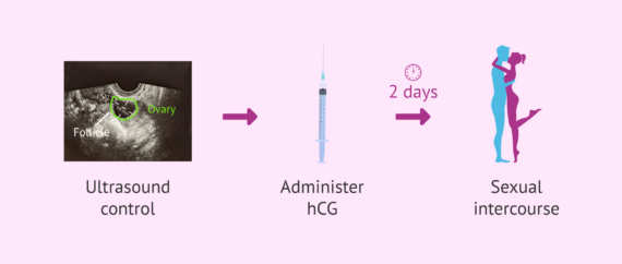 Protocol for intercourse with ovulation induction