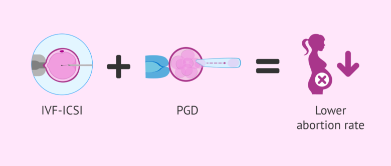 How to deal with miscarriage after an in Vitro Fertilization (IVF)?