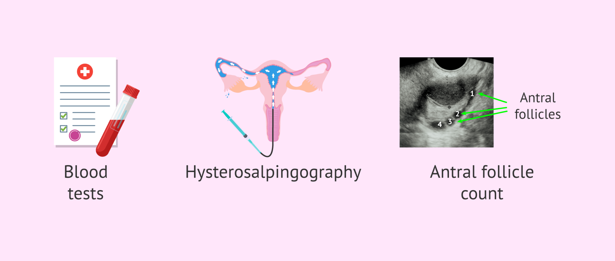What are the fertility tests for women and what do they consist of?