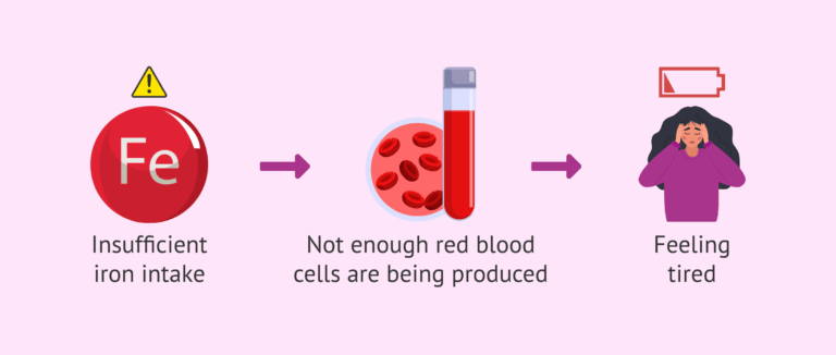 Fatigue due to iron deficiency