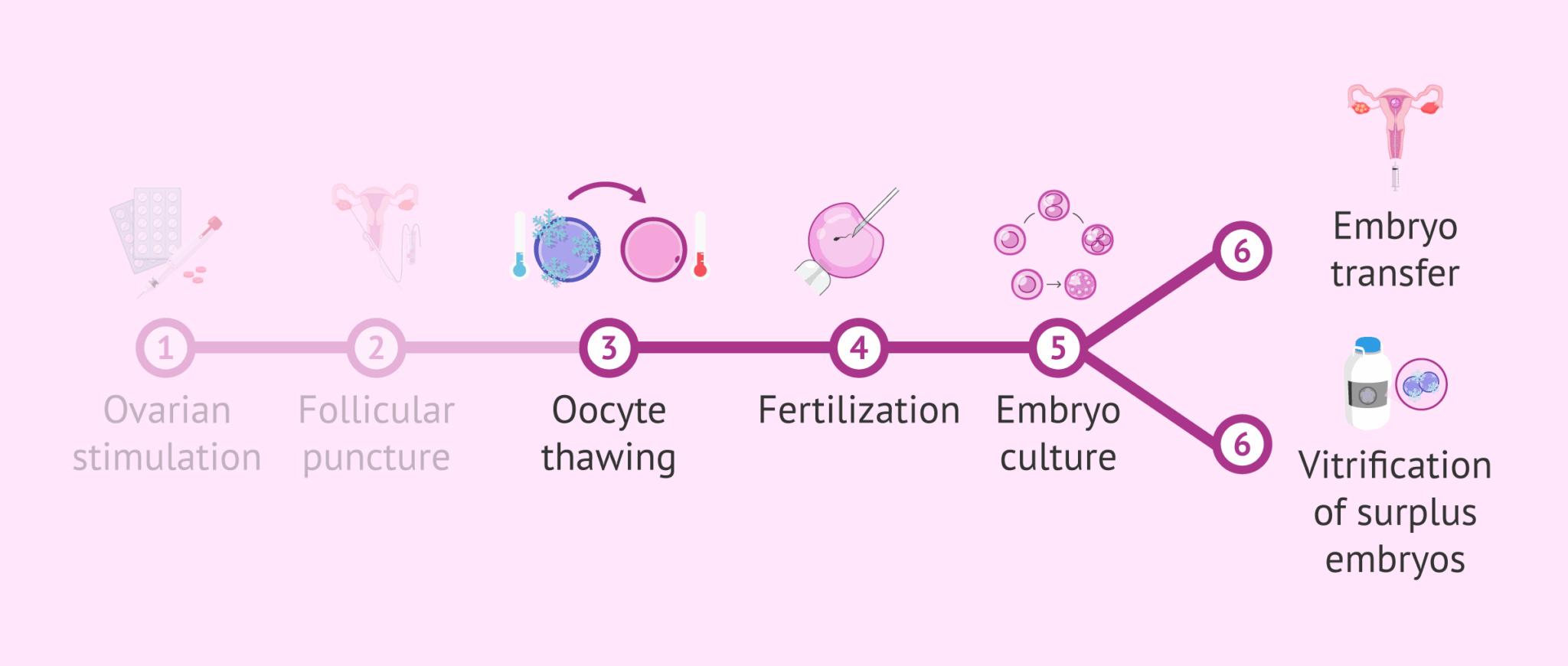 Step by step of IVF with vitrified eggs