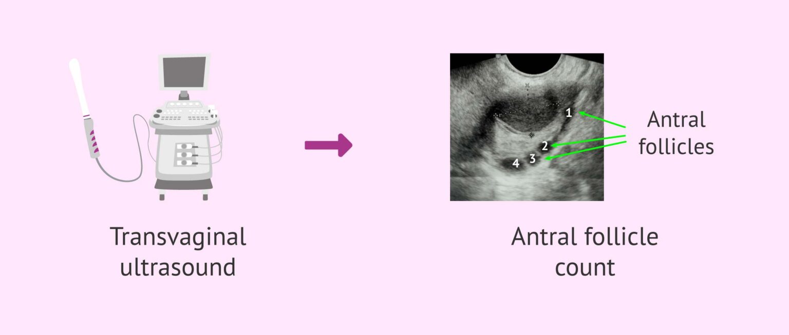Does the antral follicle count decrease in a short time?