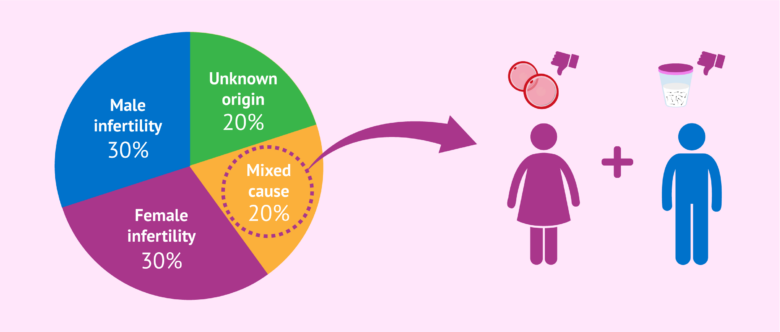 What does combined or mixed infertility refer to?